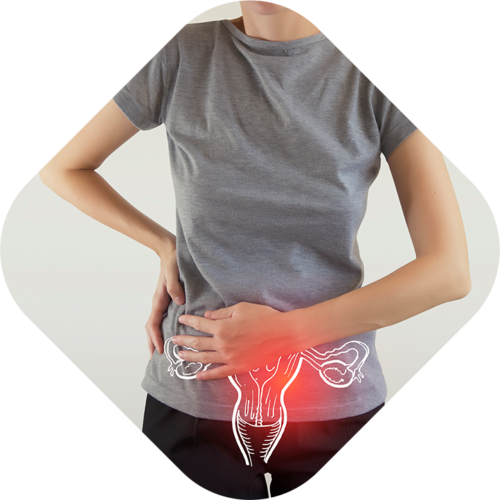 Eileiterverschluss - Dr Hit Zypern IVF-Behandlung
